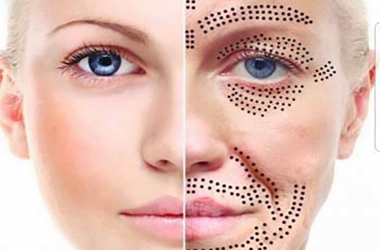 Plasma Treatment | Bella Derma Tech